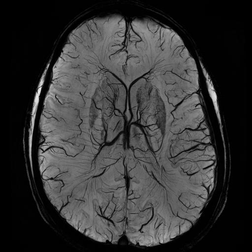 The brains behind clinical 7T MRI