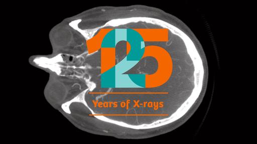 X-rays in neurology