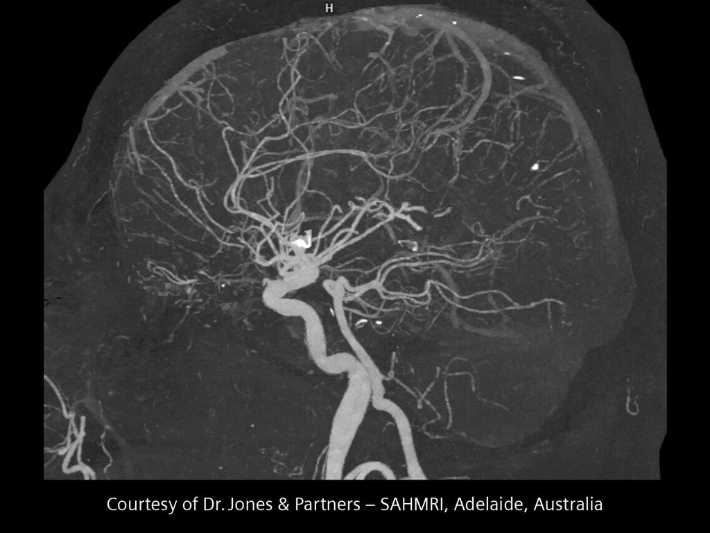 The future of computed tomography