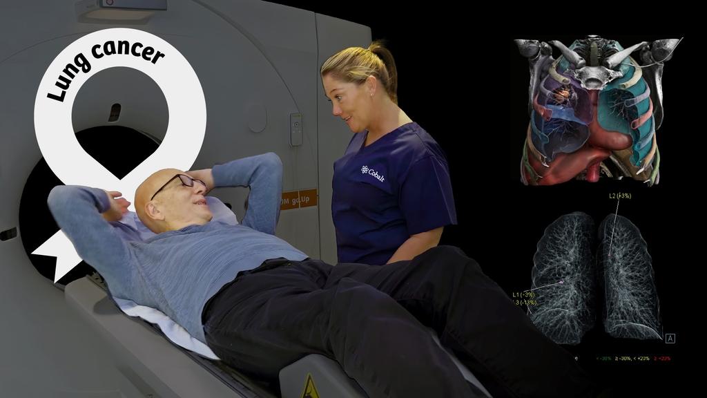 How lung cancer screening will make a difference