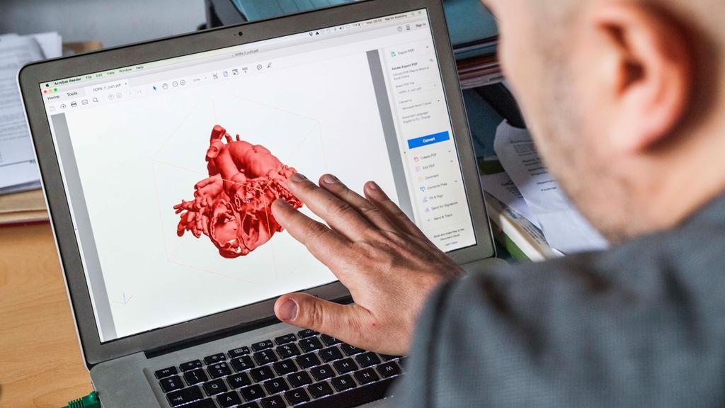 Reconstructing the Heart to Save Children’s Lives