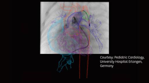 A Clear View Inside Tiny Hearts