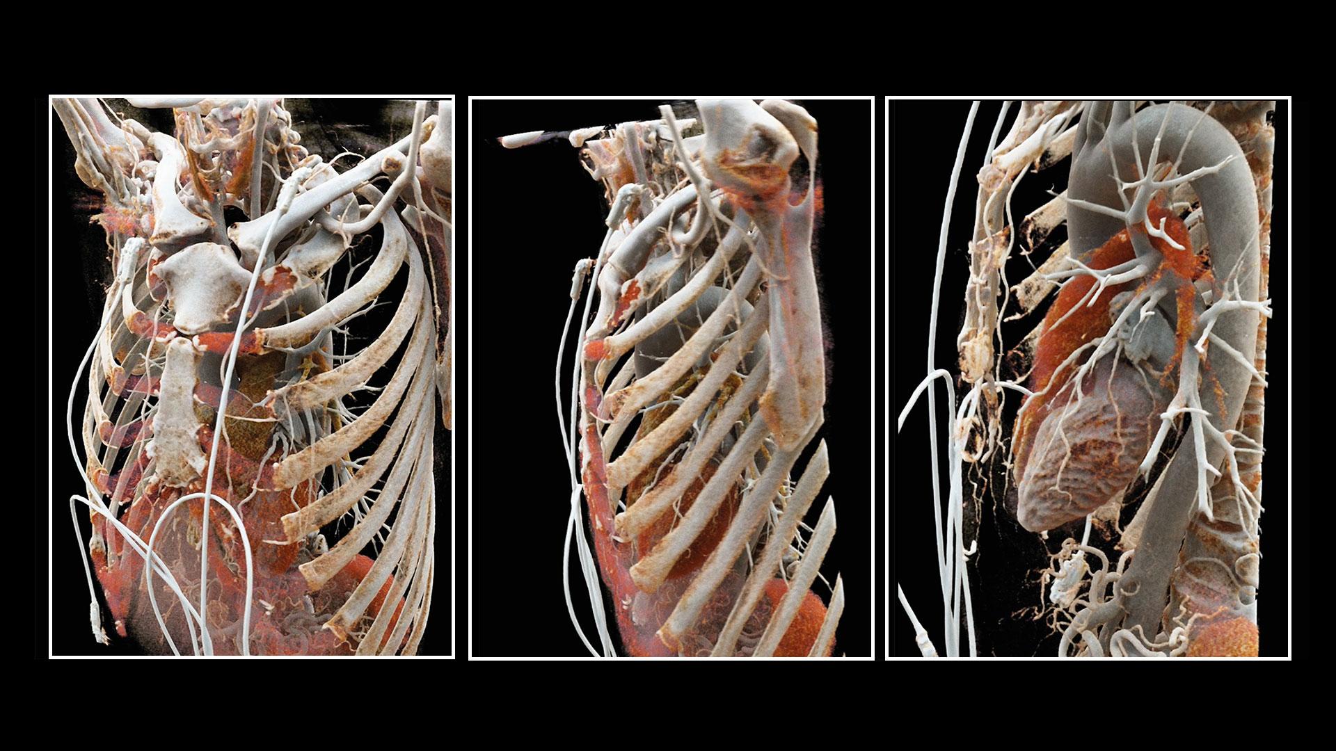 From Movies to Medicine