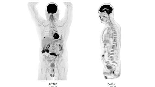 A New Era of Nuclear Medicine