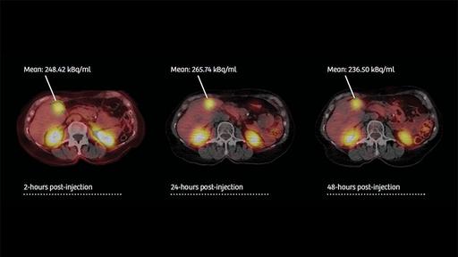 A New Era of Nuclear Medicine