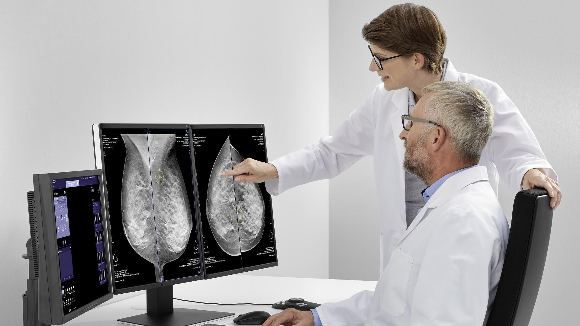 Mammography reading software from Siemens Healthineers with AI-based ...