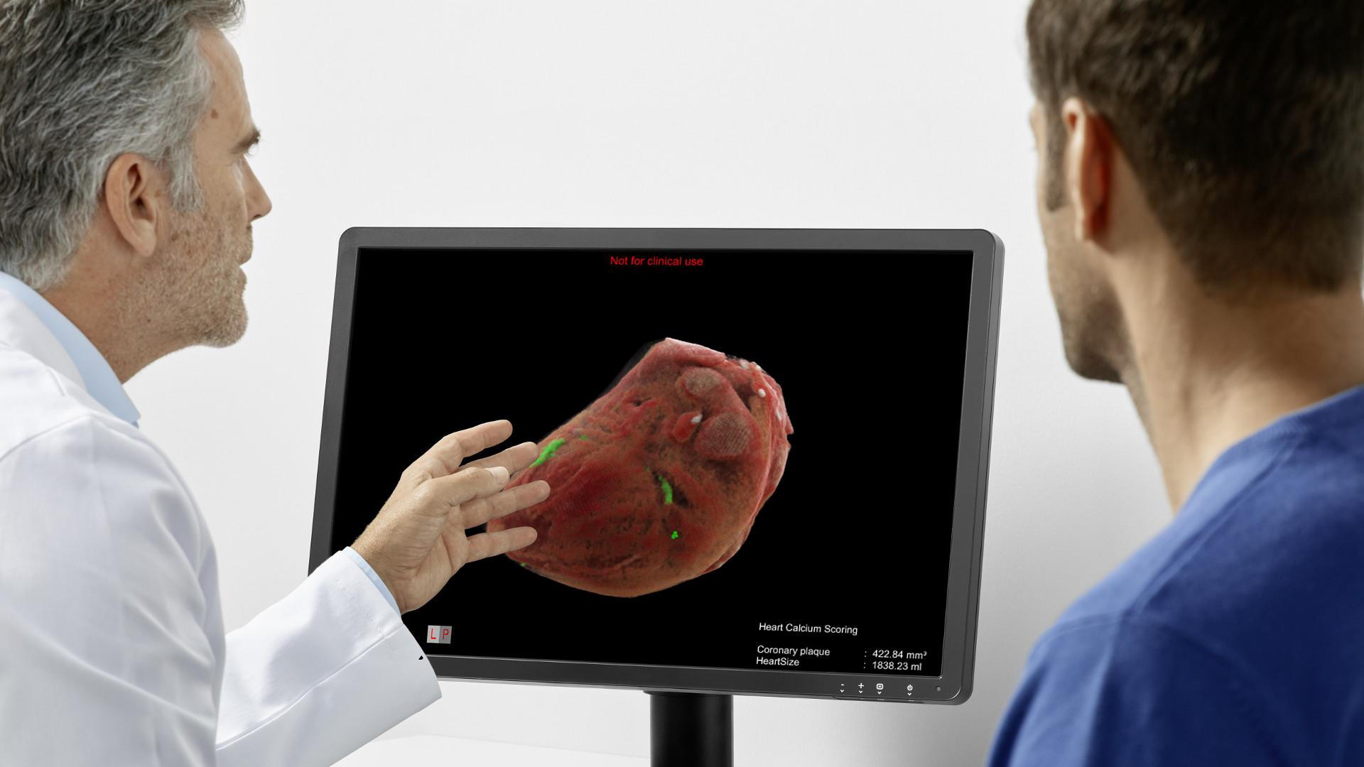 Siemens Healthineers introduces AI-Rad Companion Chest CT as first ...