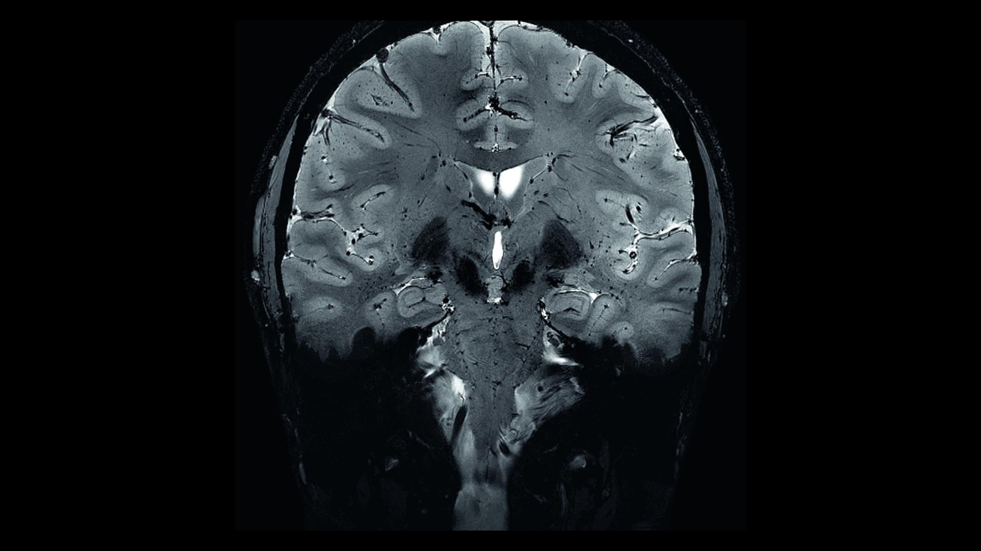 Expert on ultra-high field magnetic resonance imaging from Siemens ...