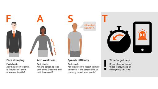Stroke care: Every minute counts