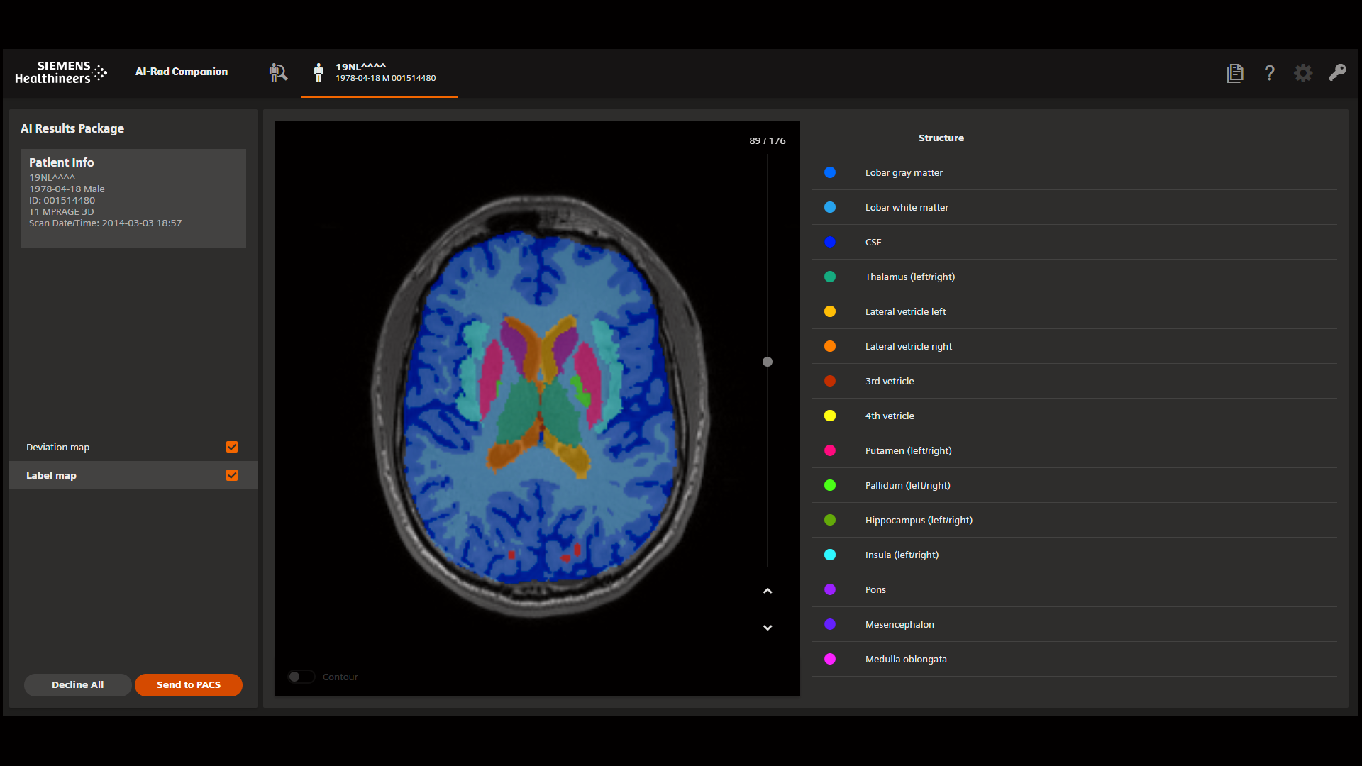 Siemens Healthineers further expanding AI portfolio in the field of ...