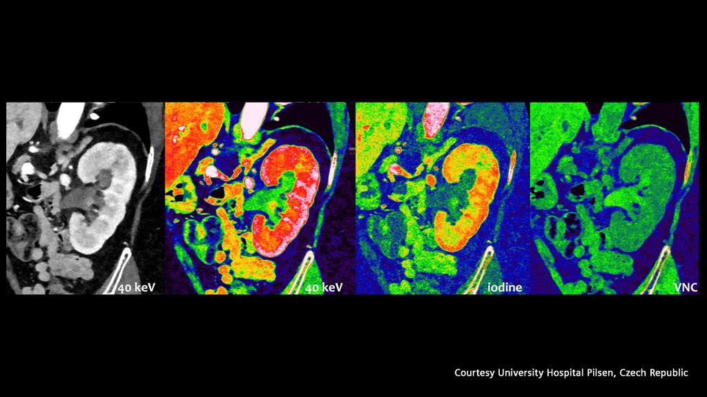 “The most important step since the advent of multislice CT”