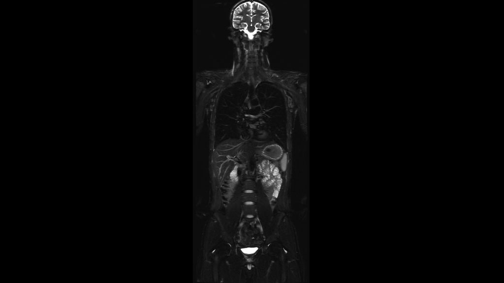 Siemens Healthineers Introduces Magnetom Flow for Greater ...