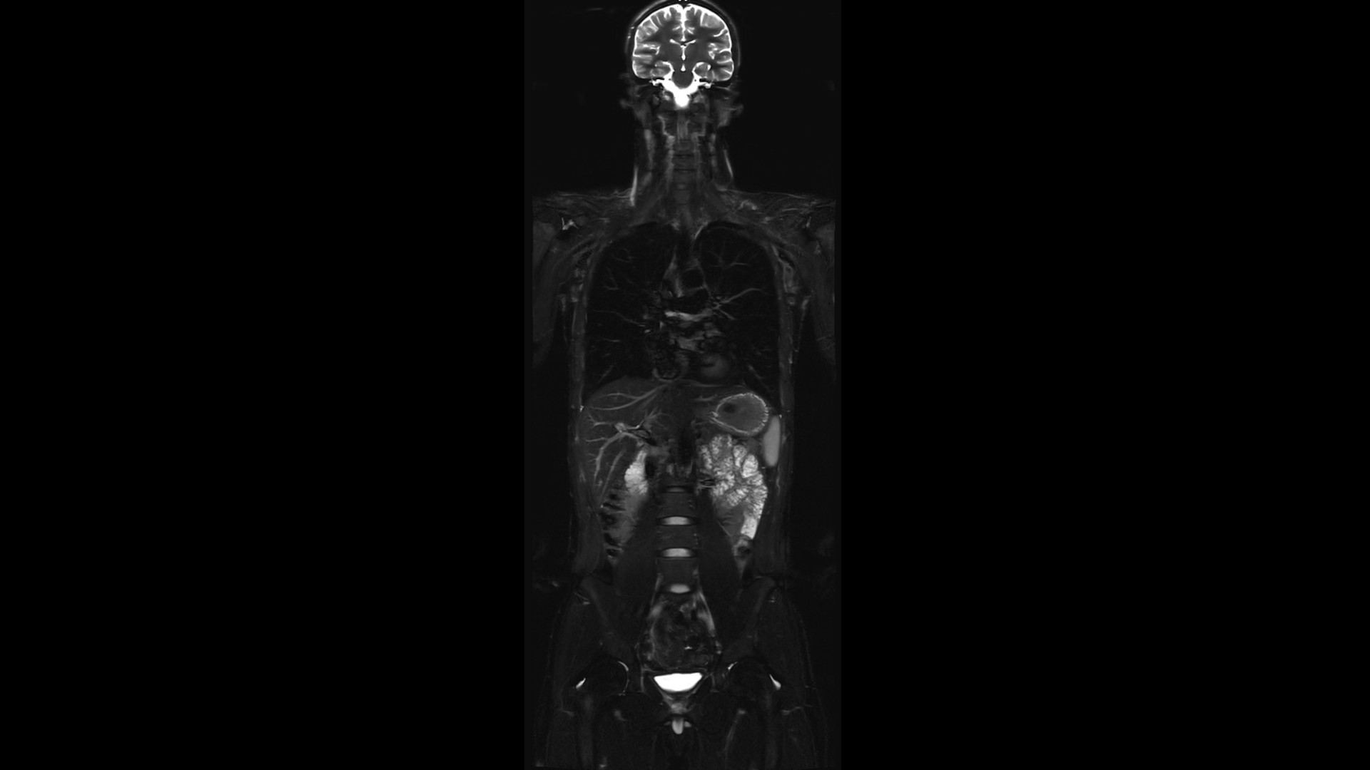 Siemens Healthineers Introduces Magnetom Flow for Greater ...