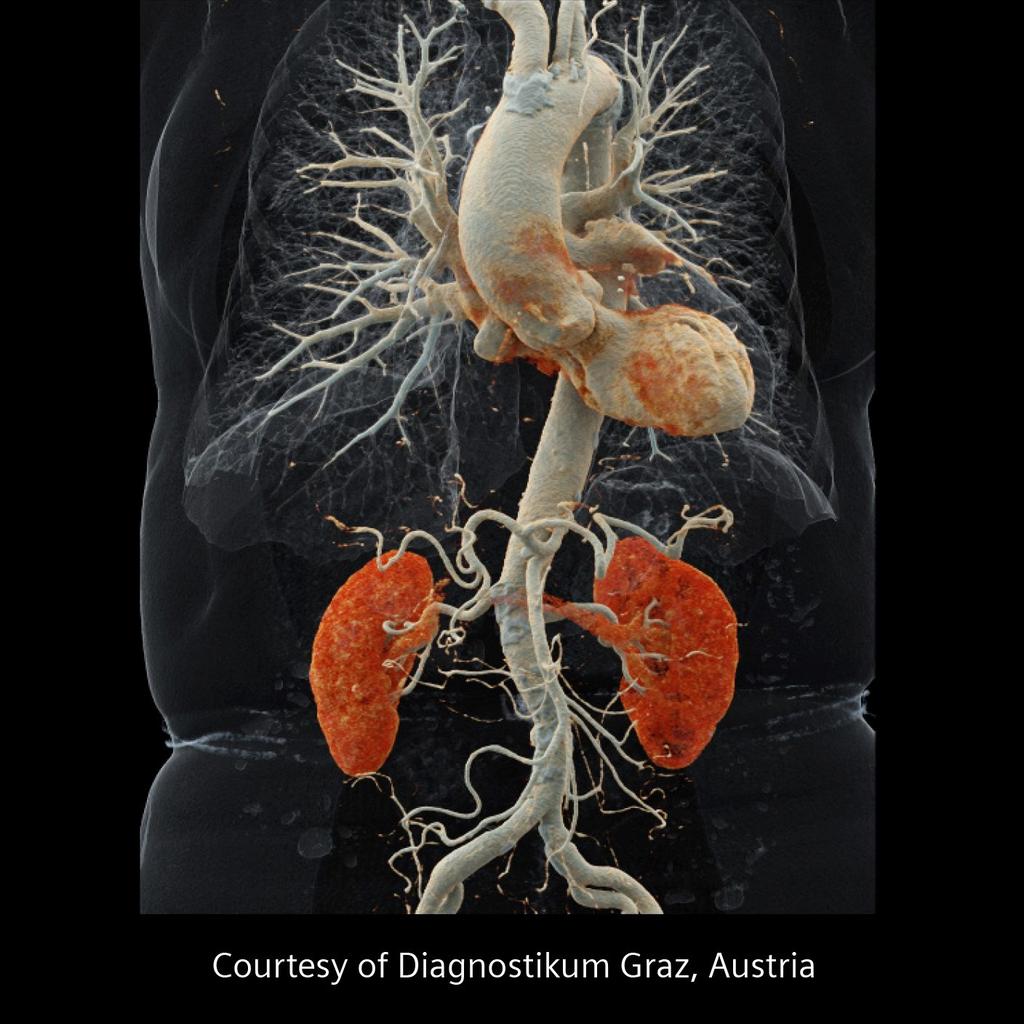 The future of computed tomography