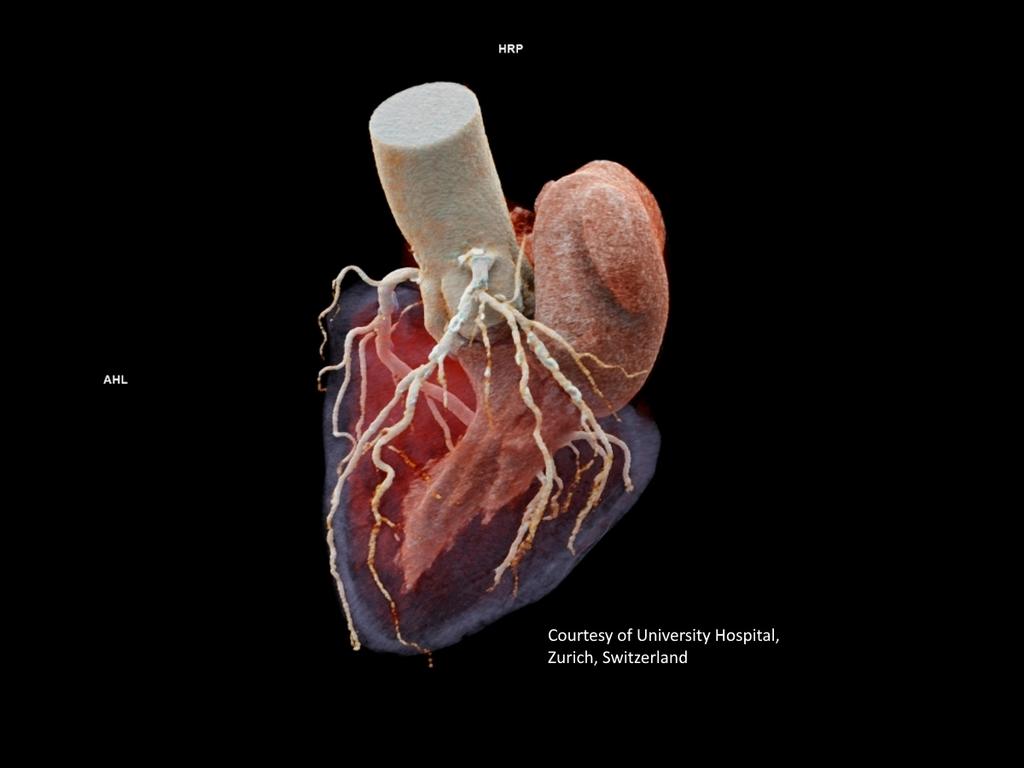 A heart is a heart. Or is it?