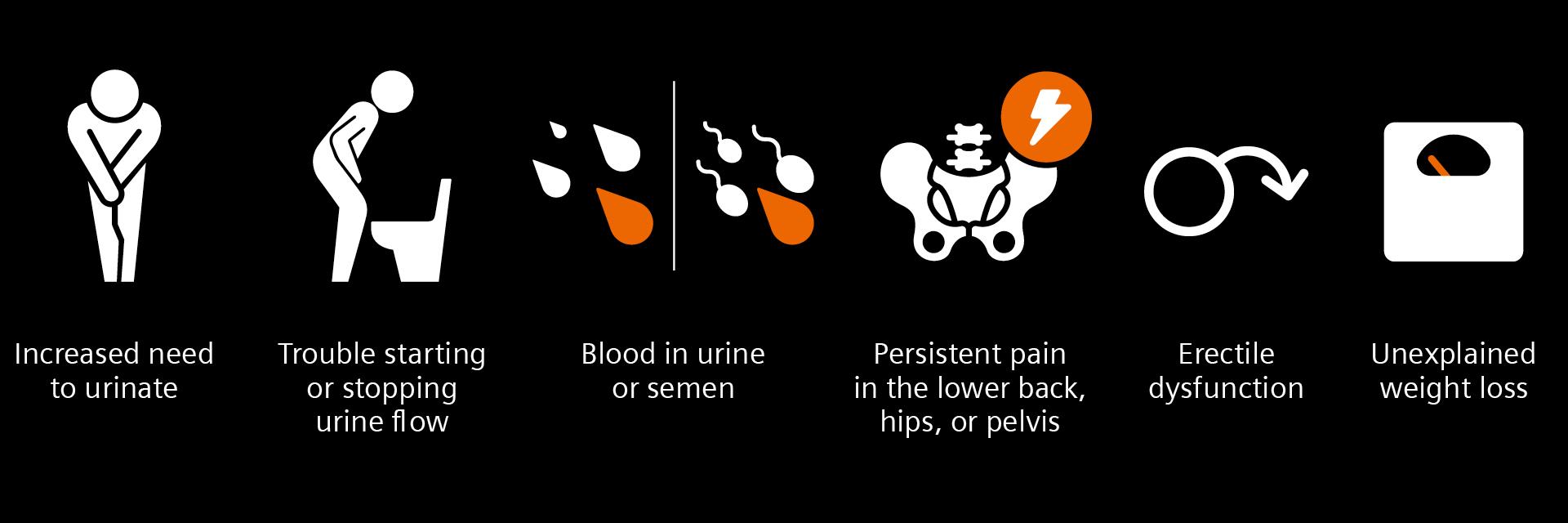 Prostate cancer: Facts, diagnosis, and treatment