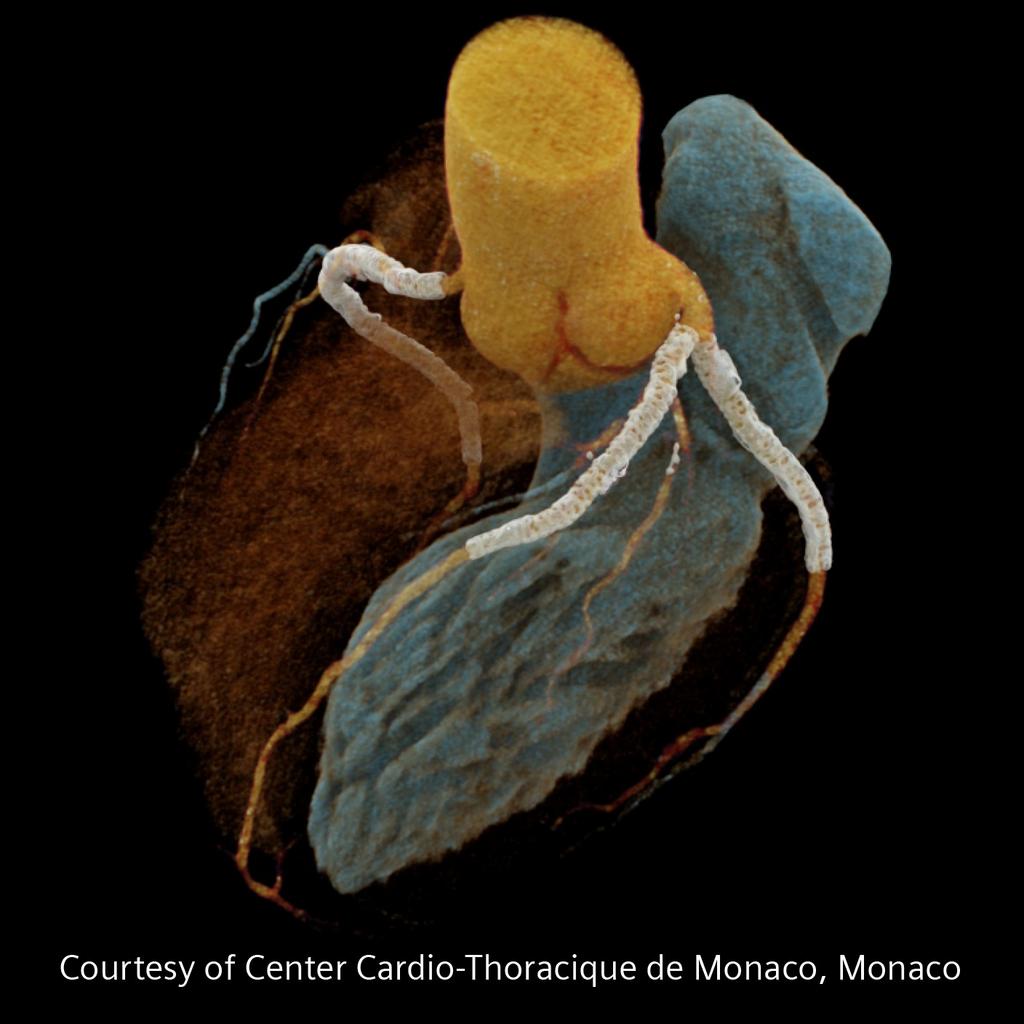 The future of computed tomography