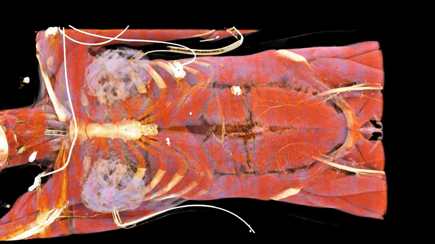 Anatomical lectures with Cinematic Anatomy