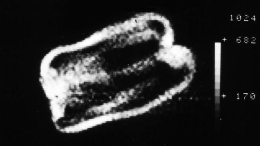 Magnetic resonance imaging: the long path to the patient