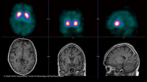 A review of nuclear neurology