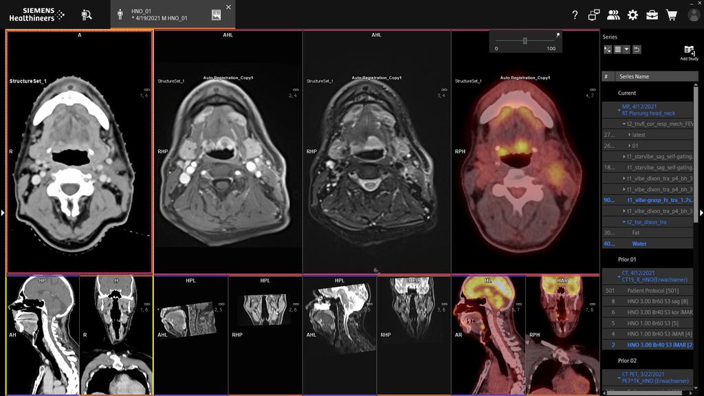 Searching for the causes of cancer
