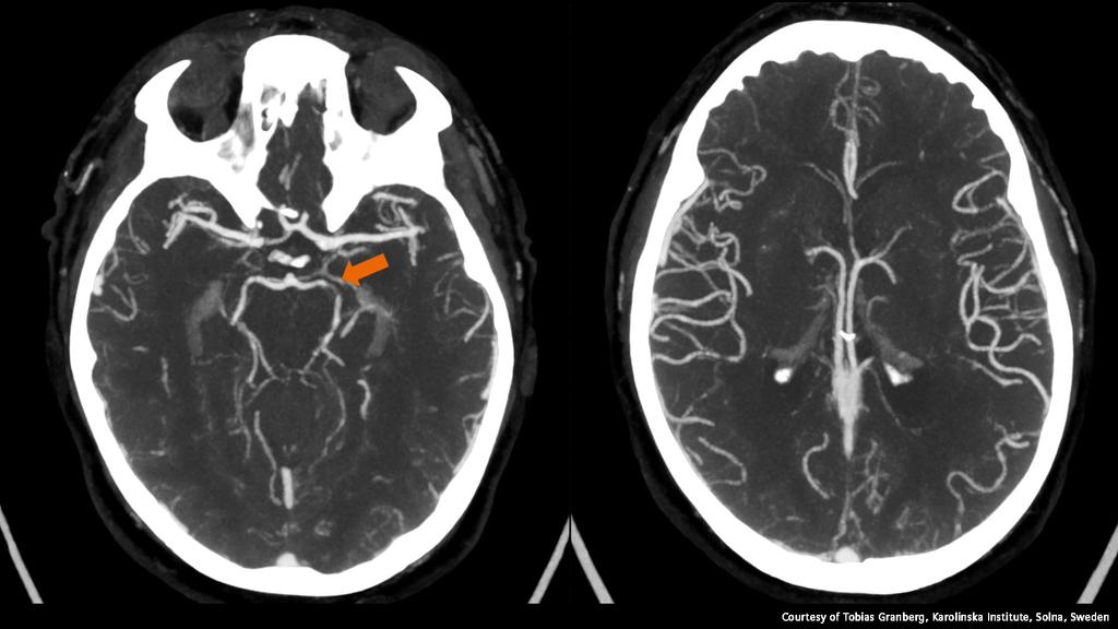 “This technology is here to stay”