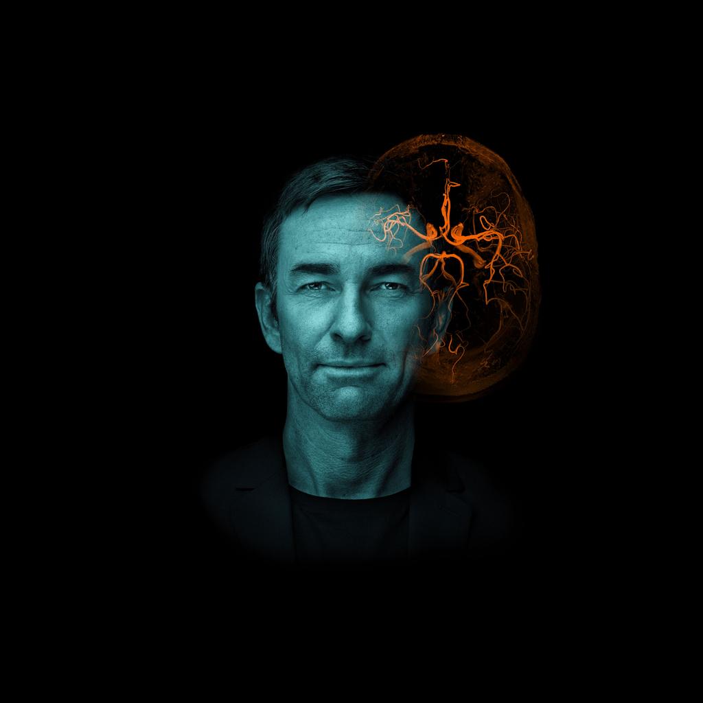 Tackling stroke with speed and precision