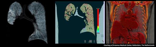 Photon-counting CT: quick and noninvasive scanning