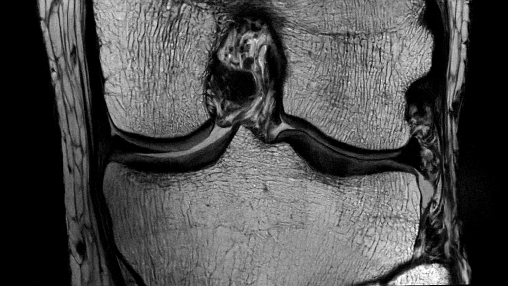 The brains behind clinical 7T MRI