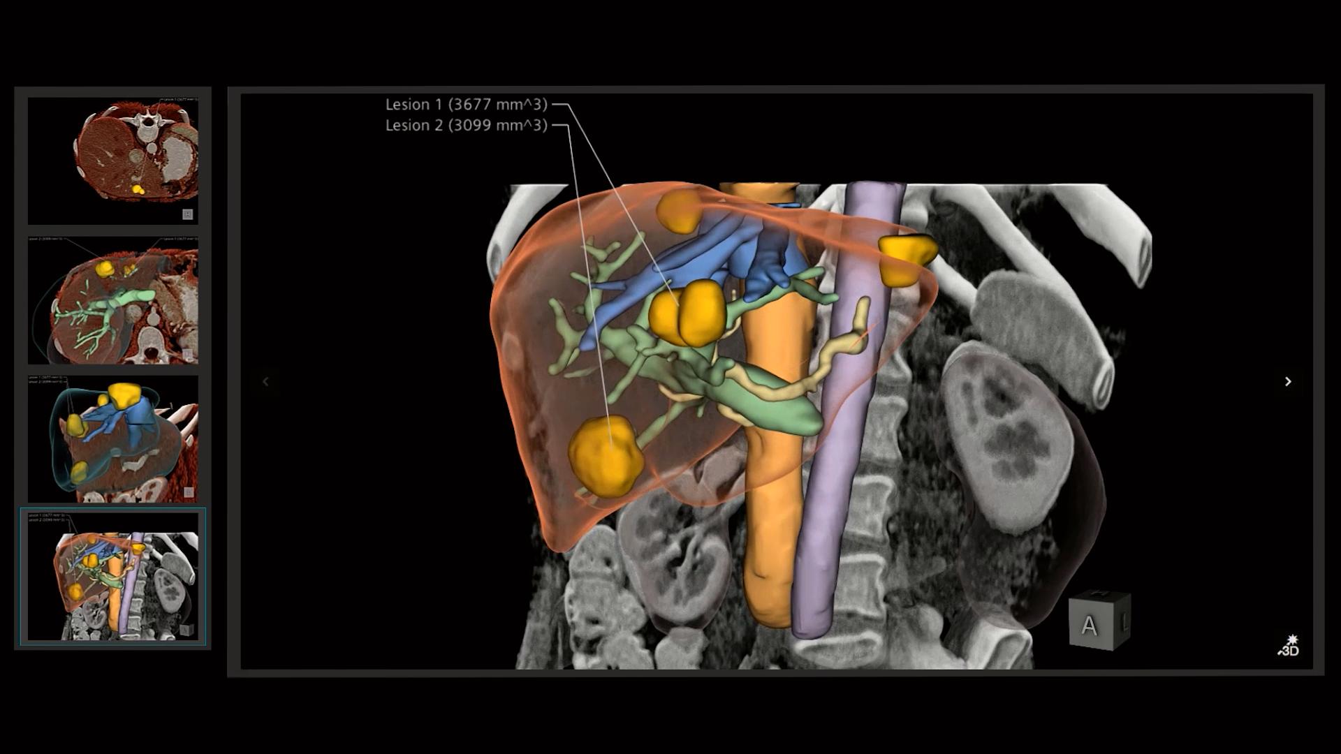 Visualizing healthcare data