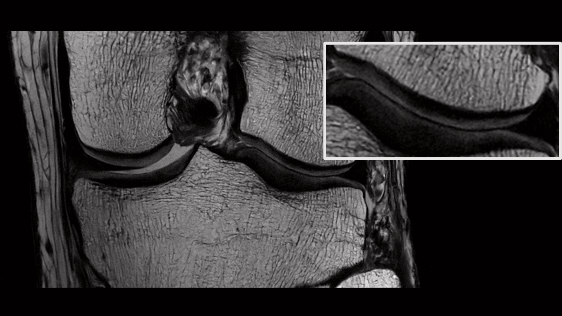 Siemens Healthineers presents two revolutionary high-end MRI scanners ...