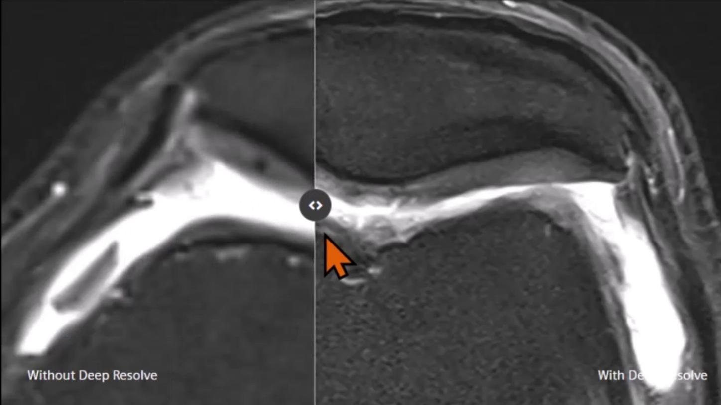 Three steps to lower energy consumption in MRI
