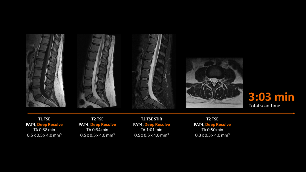 Siemens Healthineers Expands Magnetom Flow. MRI Platform in Popular 1.5 ...