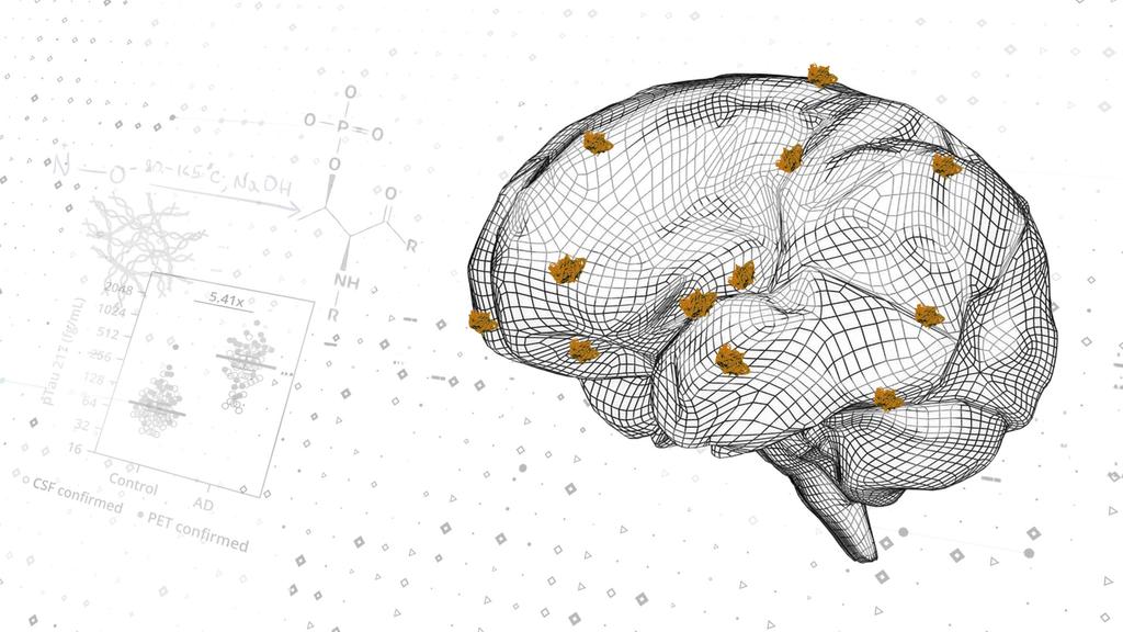 Siemens Healthineers Launches Brain Health Research Portfolio with ...