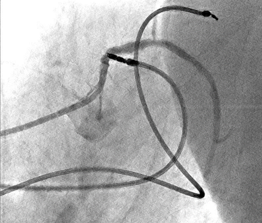 Siemens Healthineers introduces Artis icono biplane with detectors ...