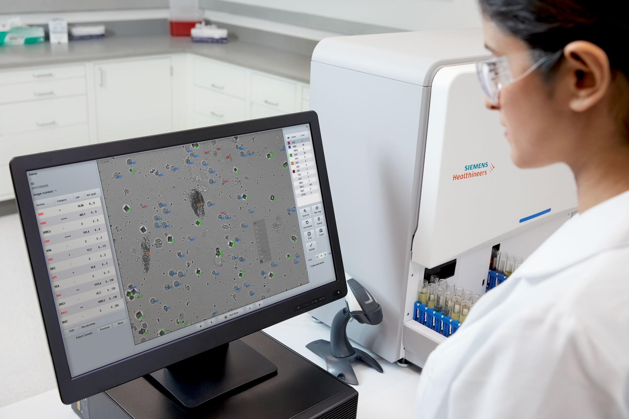 Urinalysis: A wealth of information in just a few drops